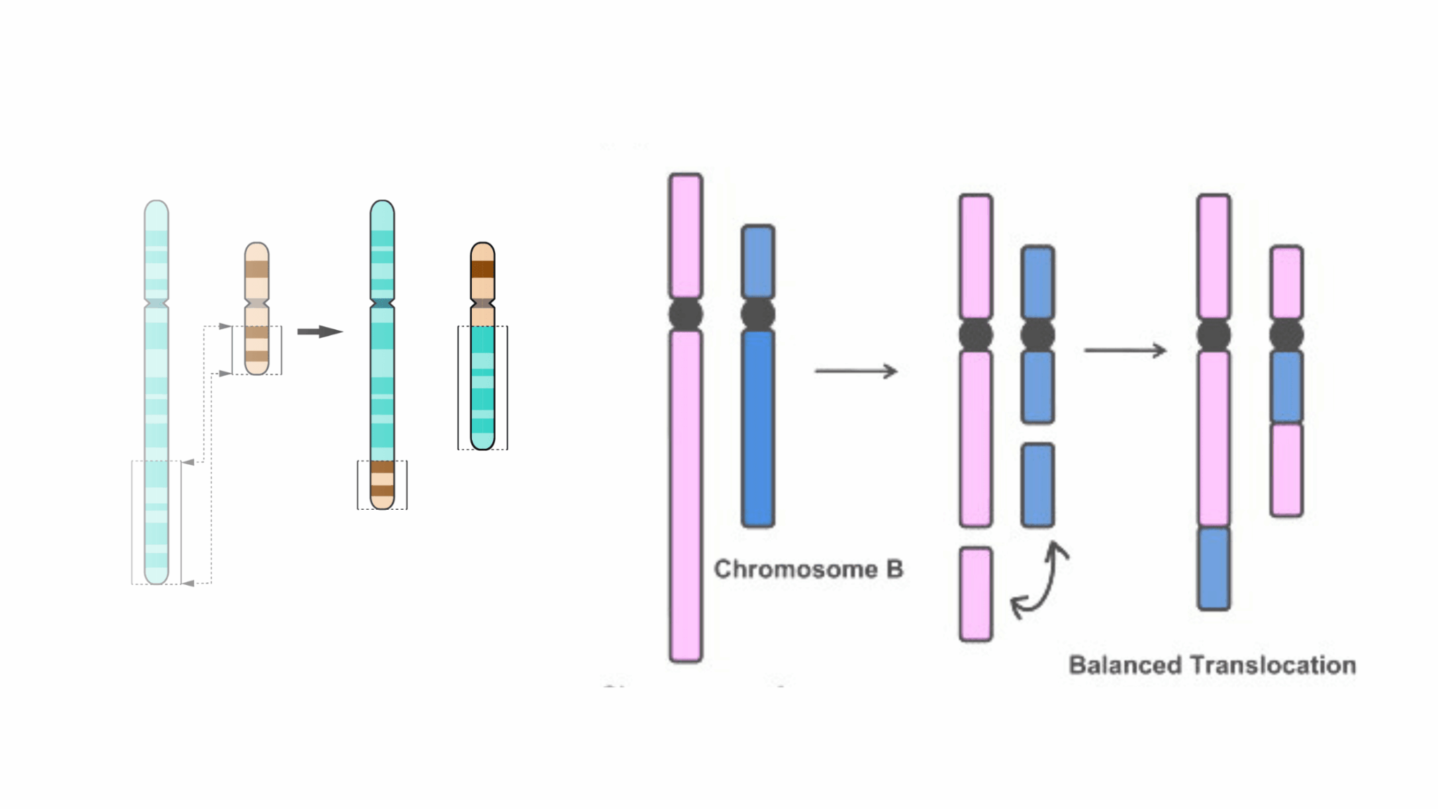 Translocation Chromosomal Aberrations